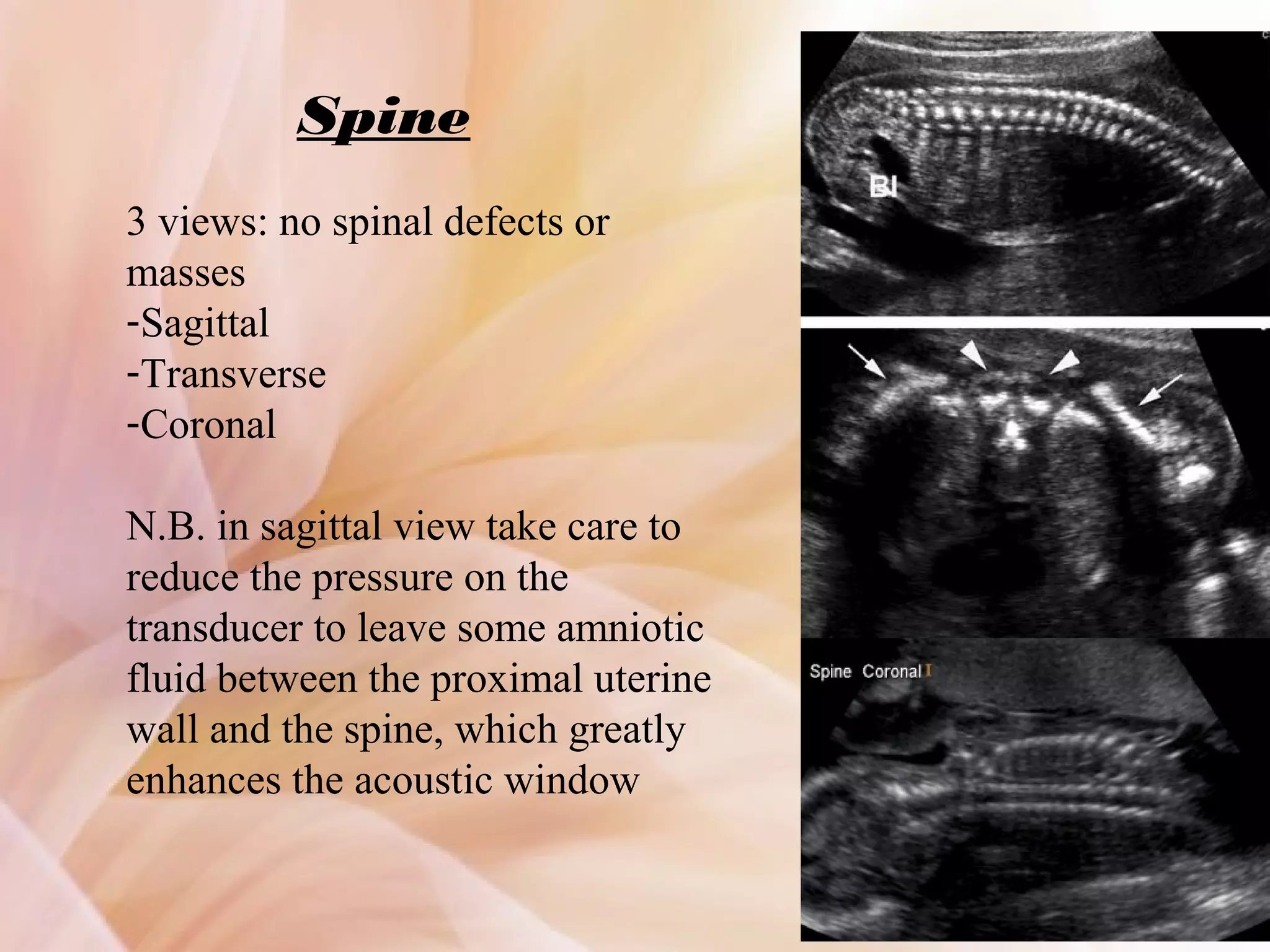 Routine fetal anatomy scan at 18-23 weeks | PPT