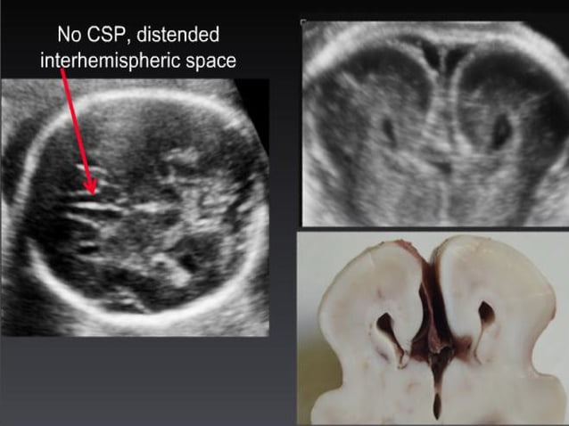 Routine fetal anatomy scan at 18-23 weeks | PPT | Pregnancy ...