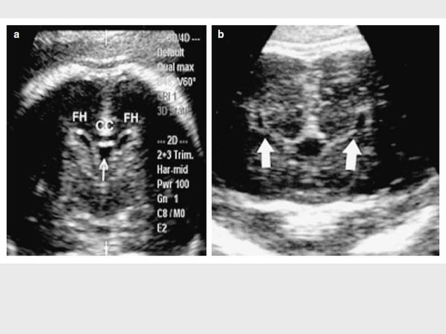 Routine fetal anatomy scan at 18-23 weeks | PPT | Pregnancy ...