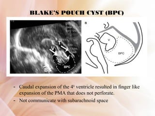 Routine fetal anatomy scan at 18-23 weeks | PPT