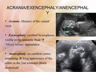 Routine fetal anatomy scan at 18-23 weeks | PPT
