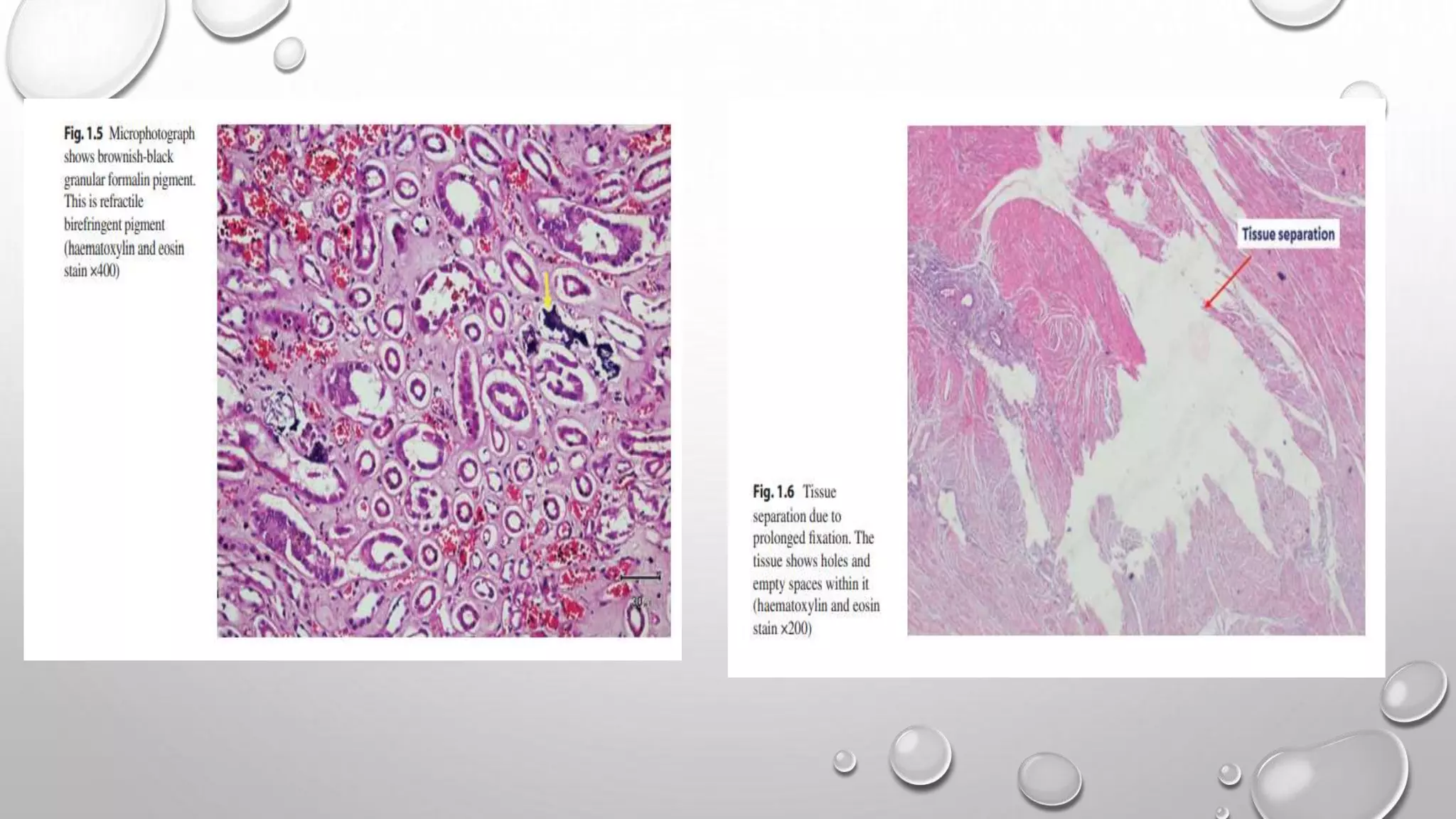 Routine histopathology techniques and staining [Autosaved].pptx ...