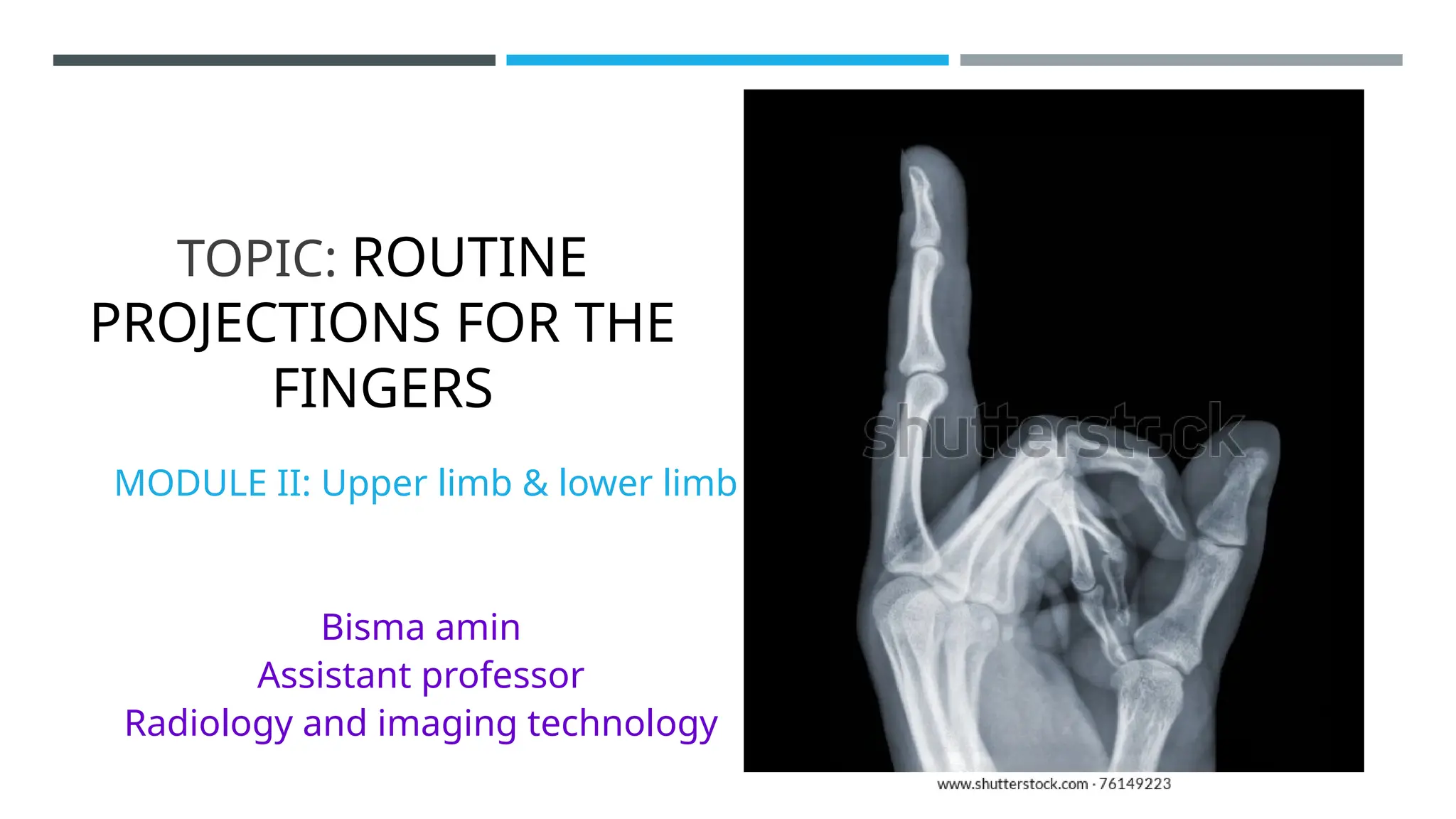 ROUTINE PROJECTIONS FOR FINGERS ppt.pptx