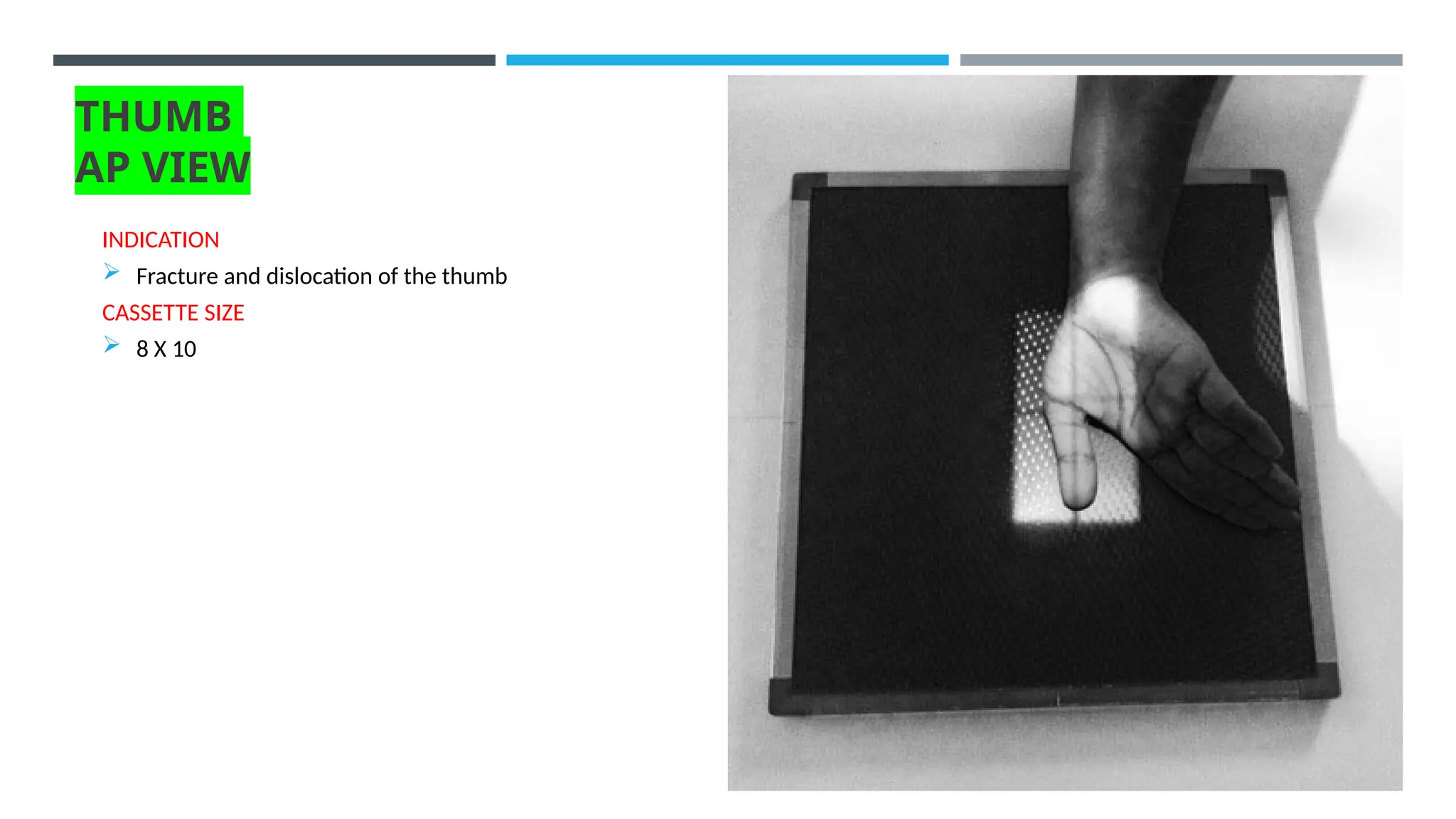 ROUTINE PROJECTIONS FOR FINGERS ppt.pptx