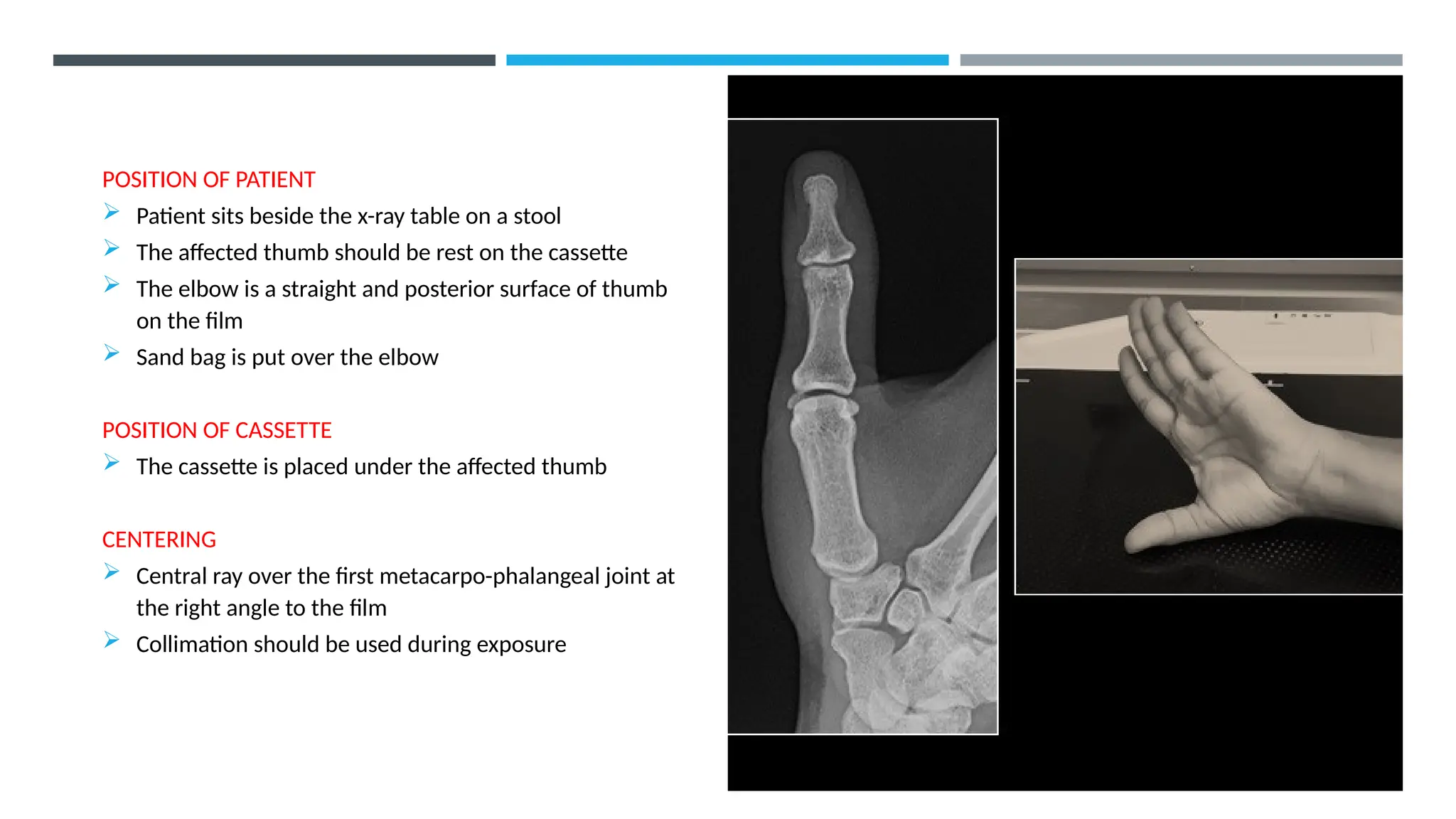 ROUTINE PROJECTIONS FOR FINGERS ppt.pptx