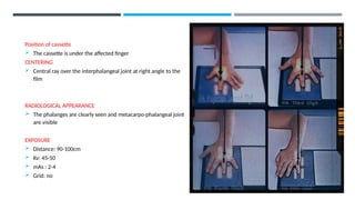 ROUTINE PROJECTIONS FOR FINGERS ppt.pptx