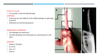 ROUTINE PROJECTIONS FOR FINGERS ppt.pptx