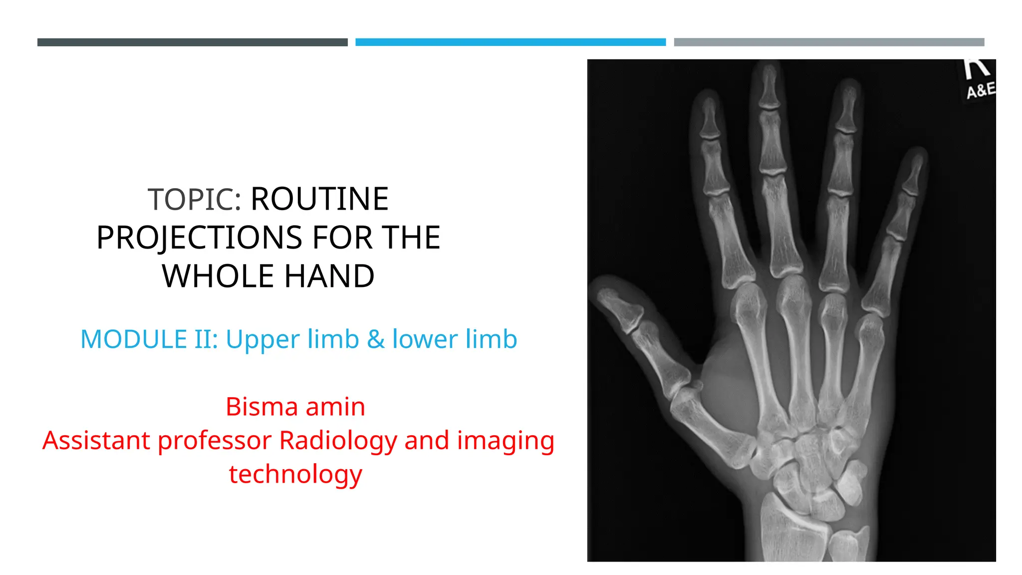 ROUTINE PROJECTIONS FOR HAND............ | PPTX