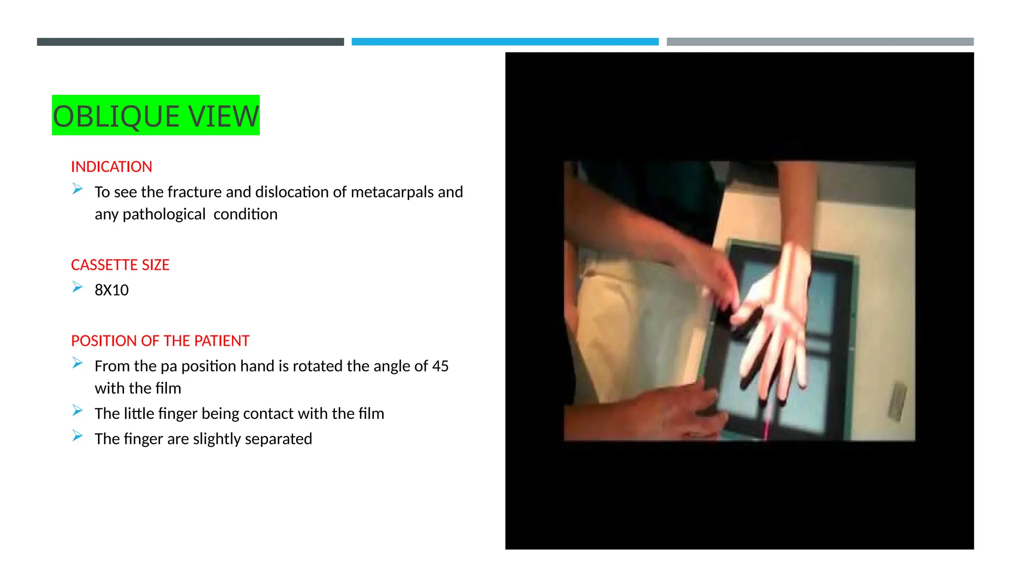 ROUTINE PROJECTIONS FOR HAND............ | PPTX