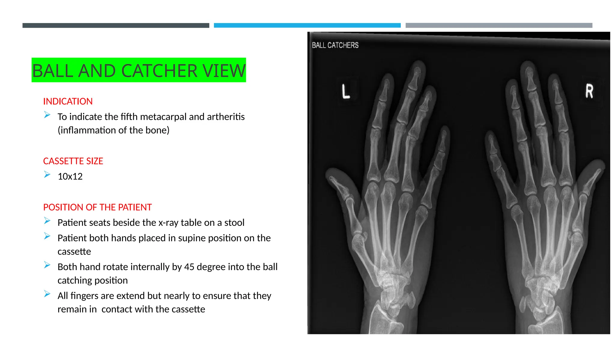 ROUTINE PROJECTIONS FOR HAND............ | PPTX
