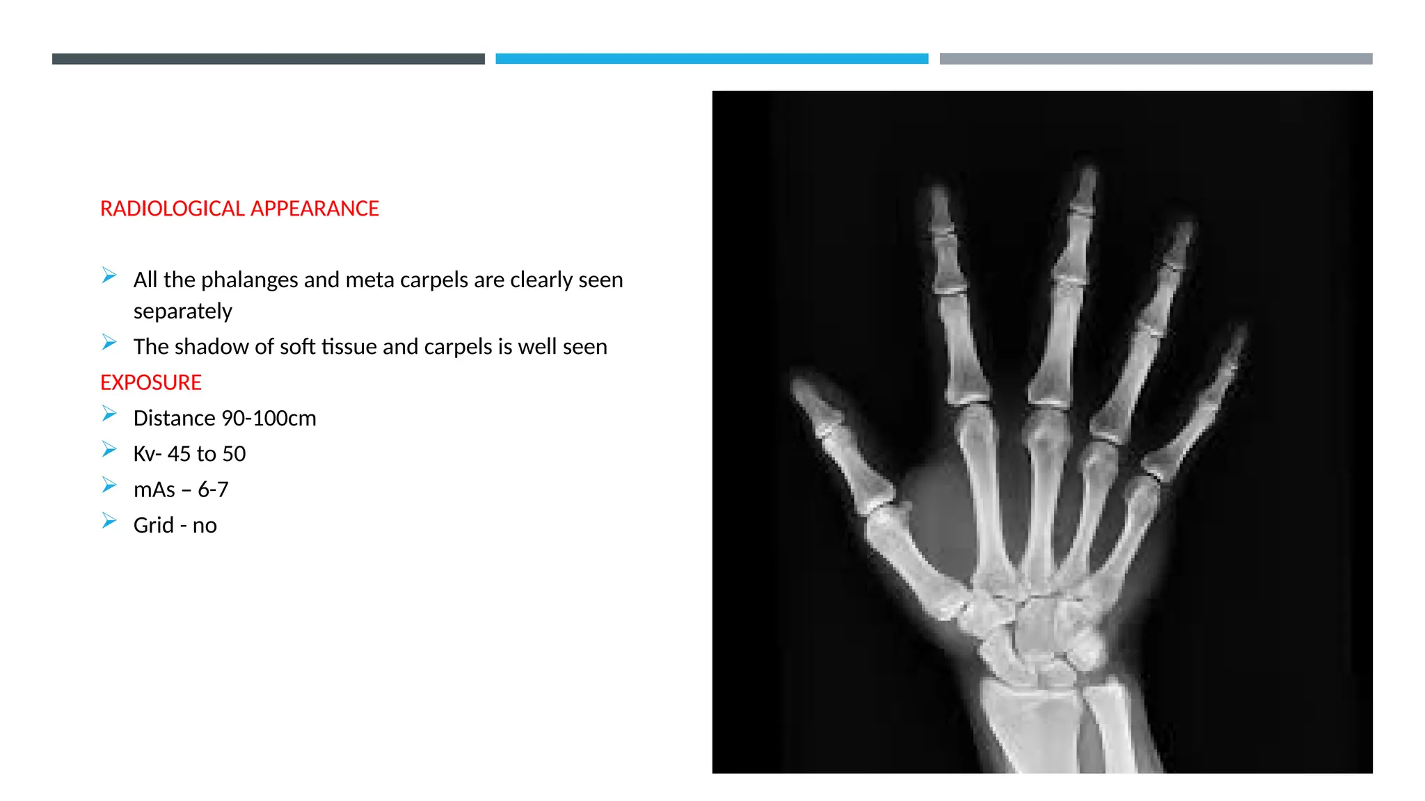 ROUTINE PROJECTIONS FOR HAND............ | PPTX