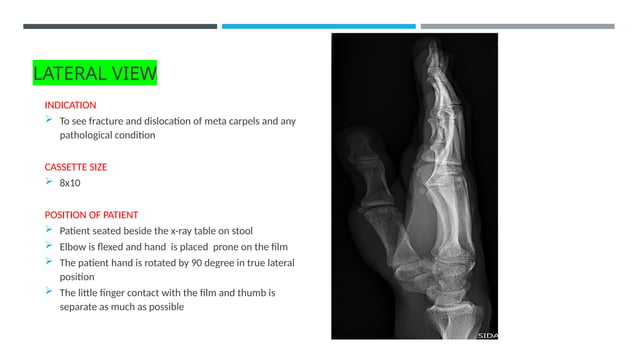 ROUTINE PROJECTIONS FOR HAND............ | PPTX
