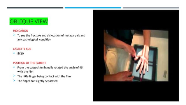 ROUTINE PROJECTIONS FOR HAND............ | PPTX