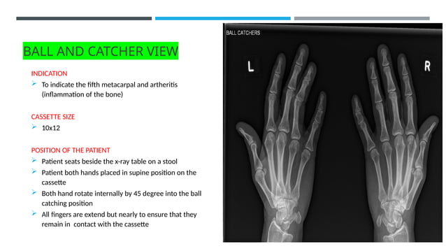ROUTINE PROJECTIONS FOR HAND............ | PPTX