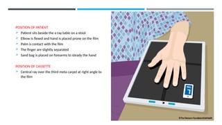 ROUTINE PROJECTIONS FOR HAND............ | PPTX