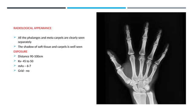 ROUTINE PROJECTIONS FOR HAND............ | PPTX