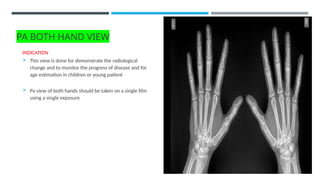 ROUTINE PROJECTIONS FOR HAND............ | PPTX