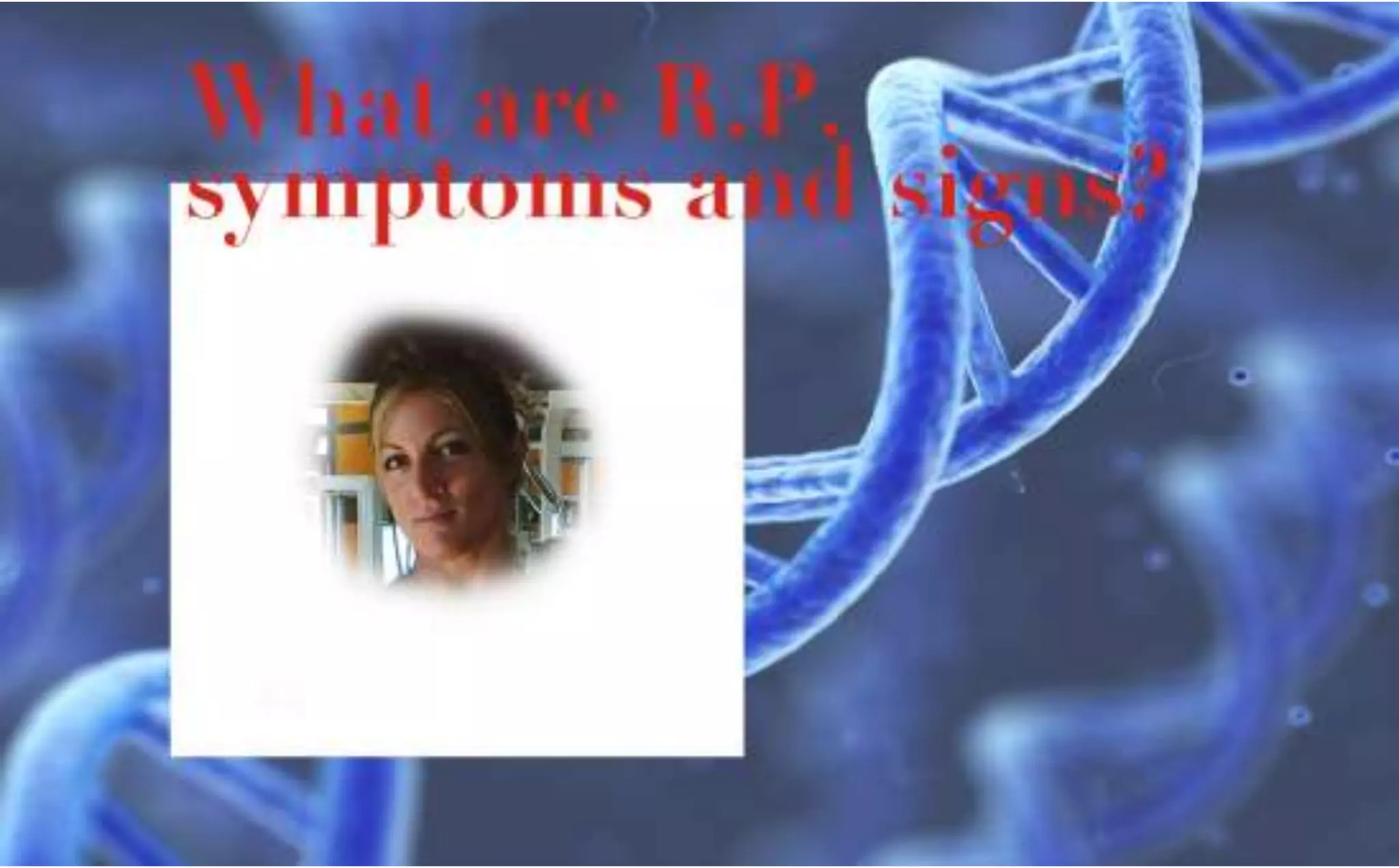 Retinitis Pigmentosa | PPTX