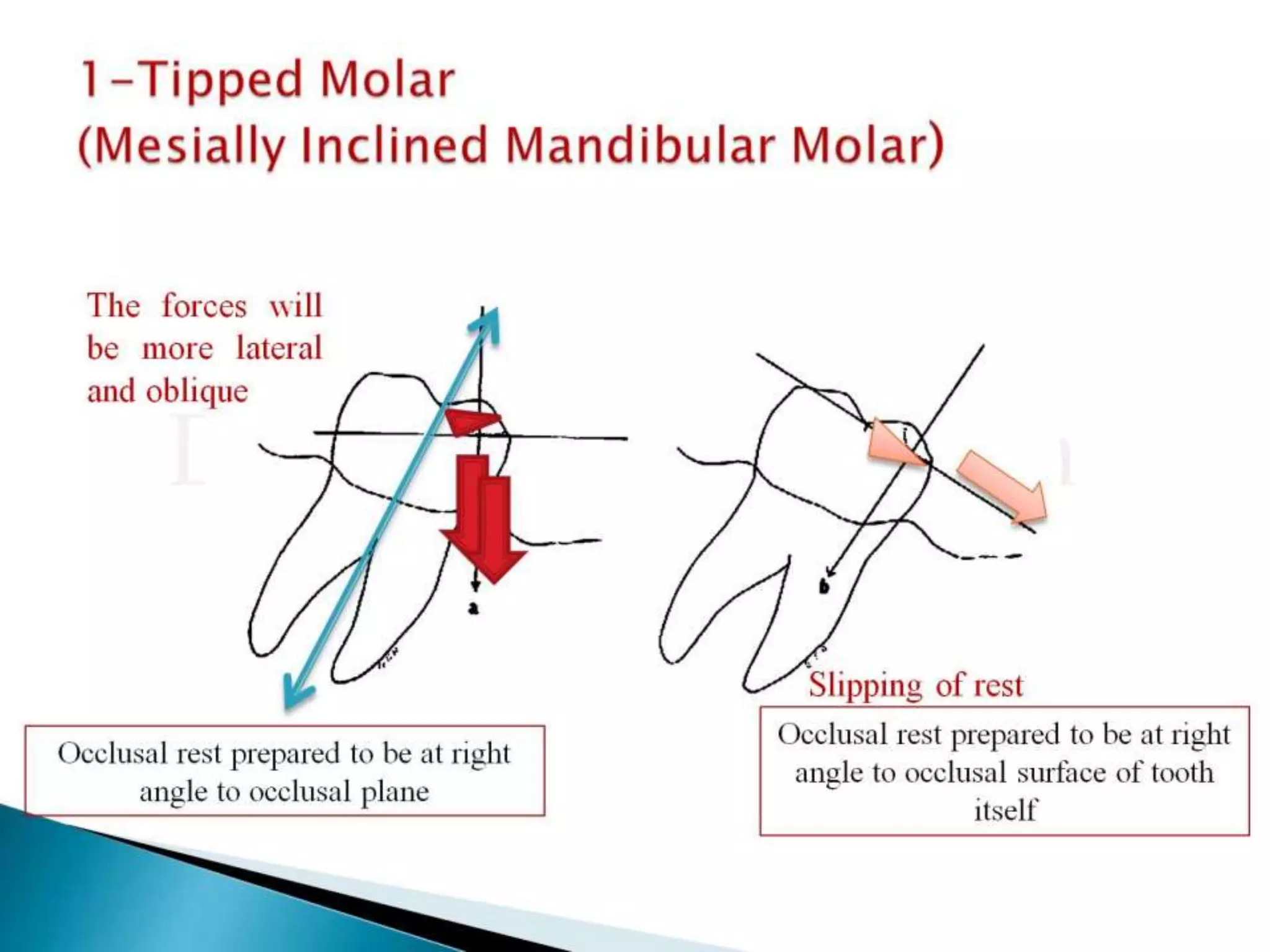 Rpd. rests & rest seats 2nd yr | PPTX