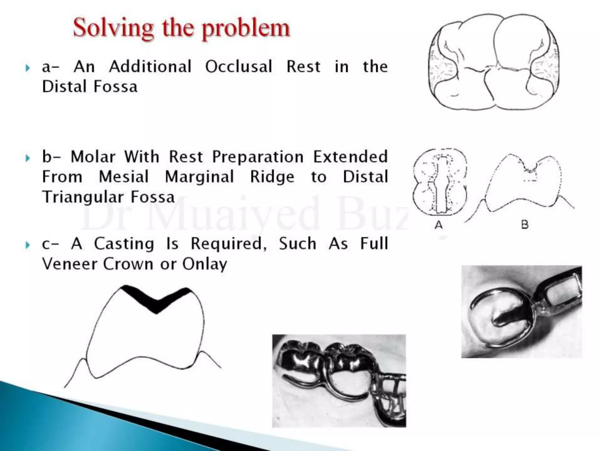Rpd. rests & rest seats 2nd yr | PPTX