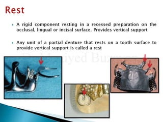 Rpd. rests & rest seats 2nd yr | PPTX