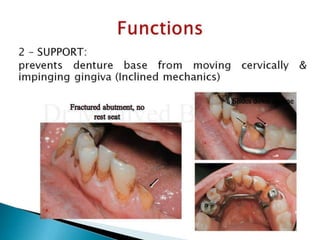 Rpd. rests & rest seats 2nd yr | PPTX