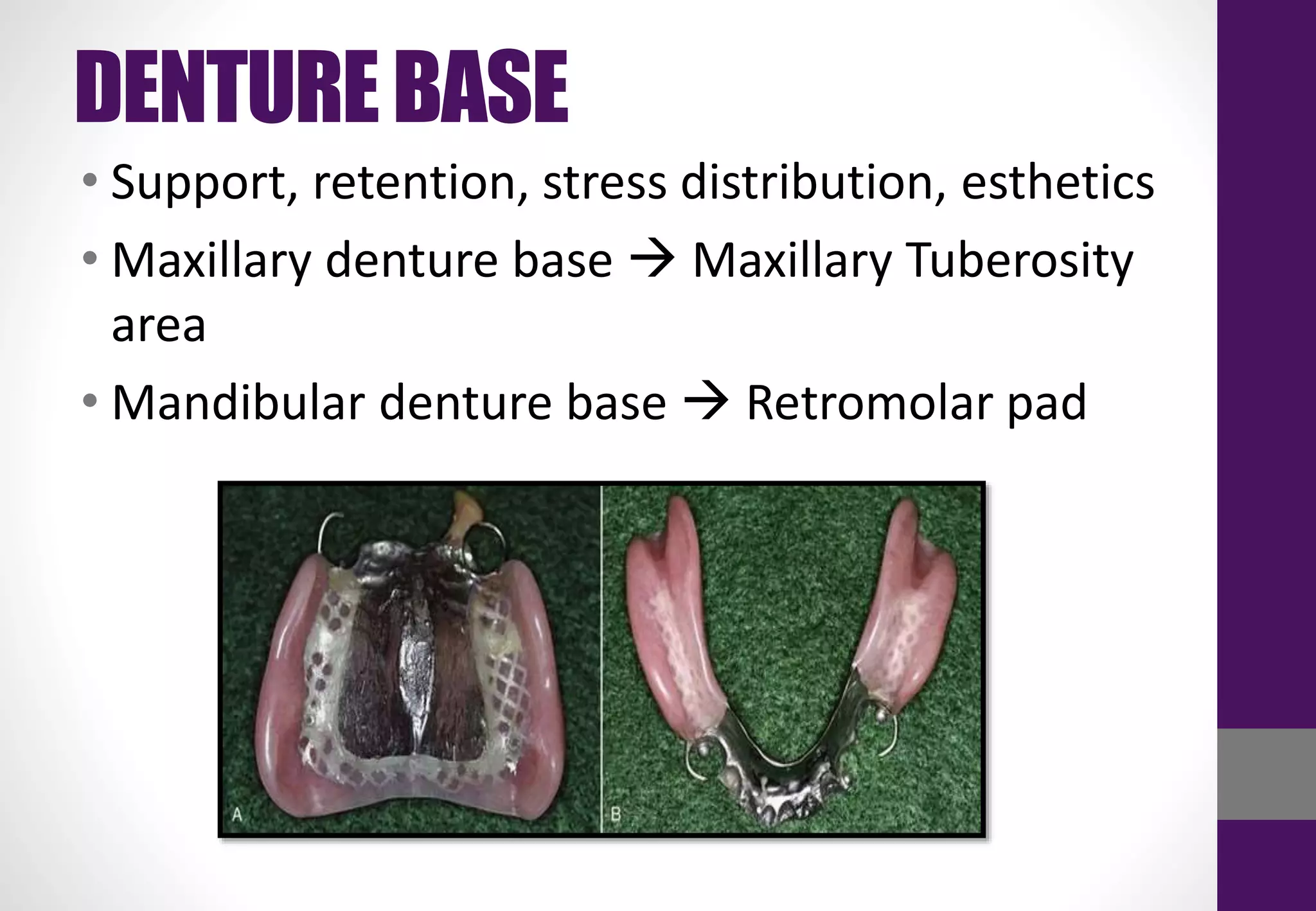 Removable partial denture | PPTX