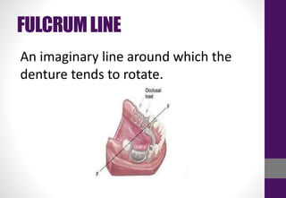 Removable partial denture | PPTX