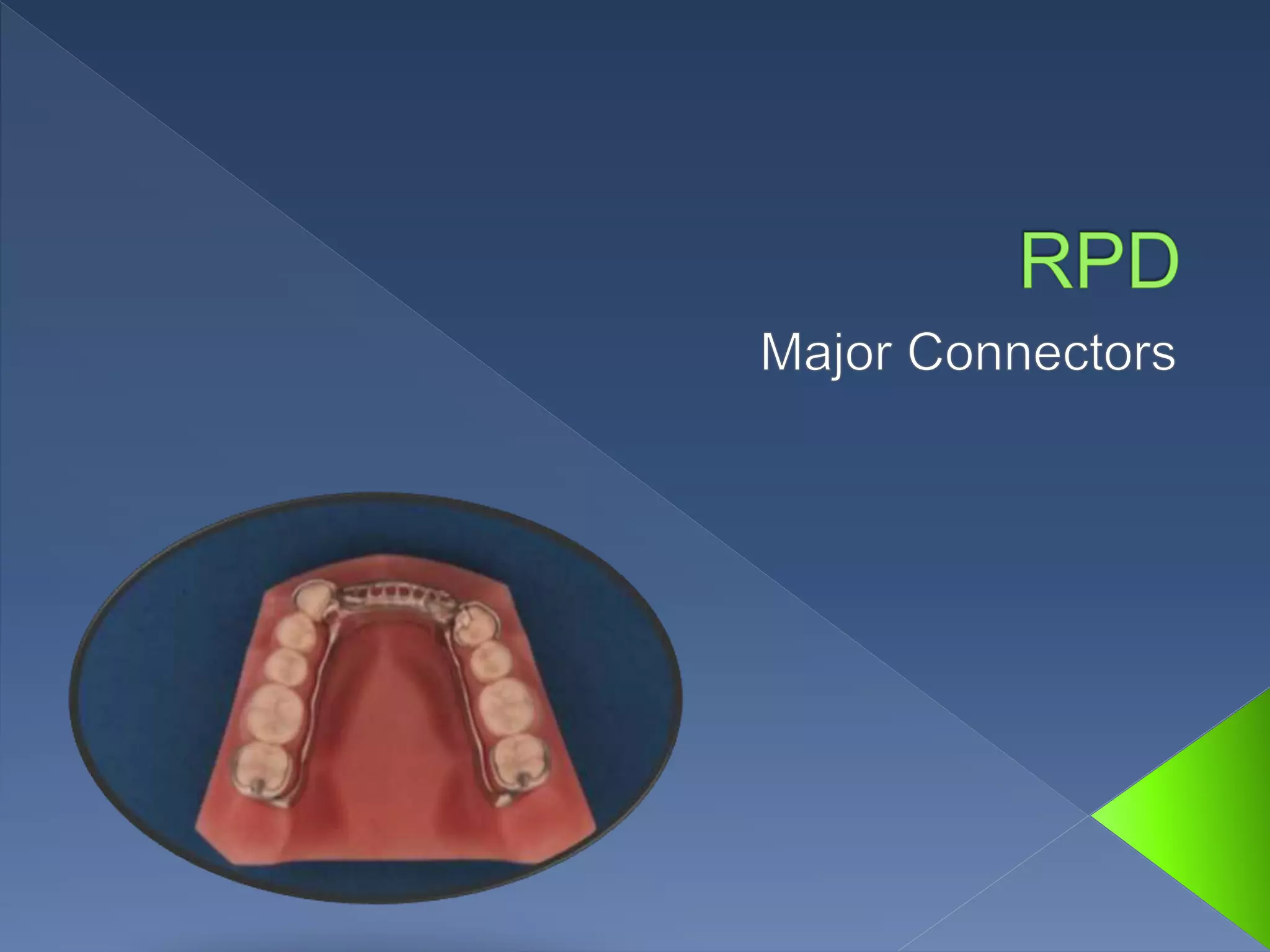 RPD Major Connectors | PPSX