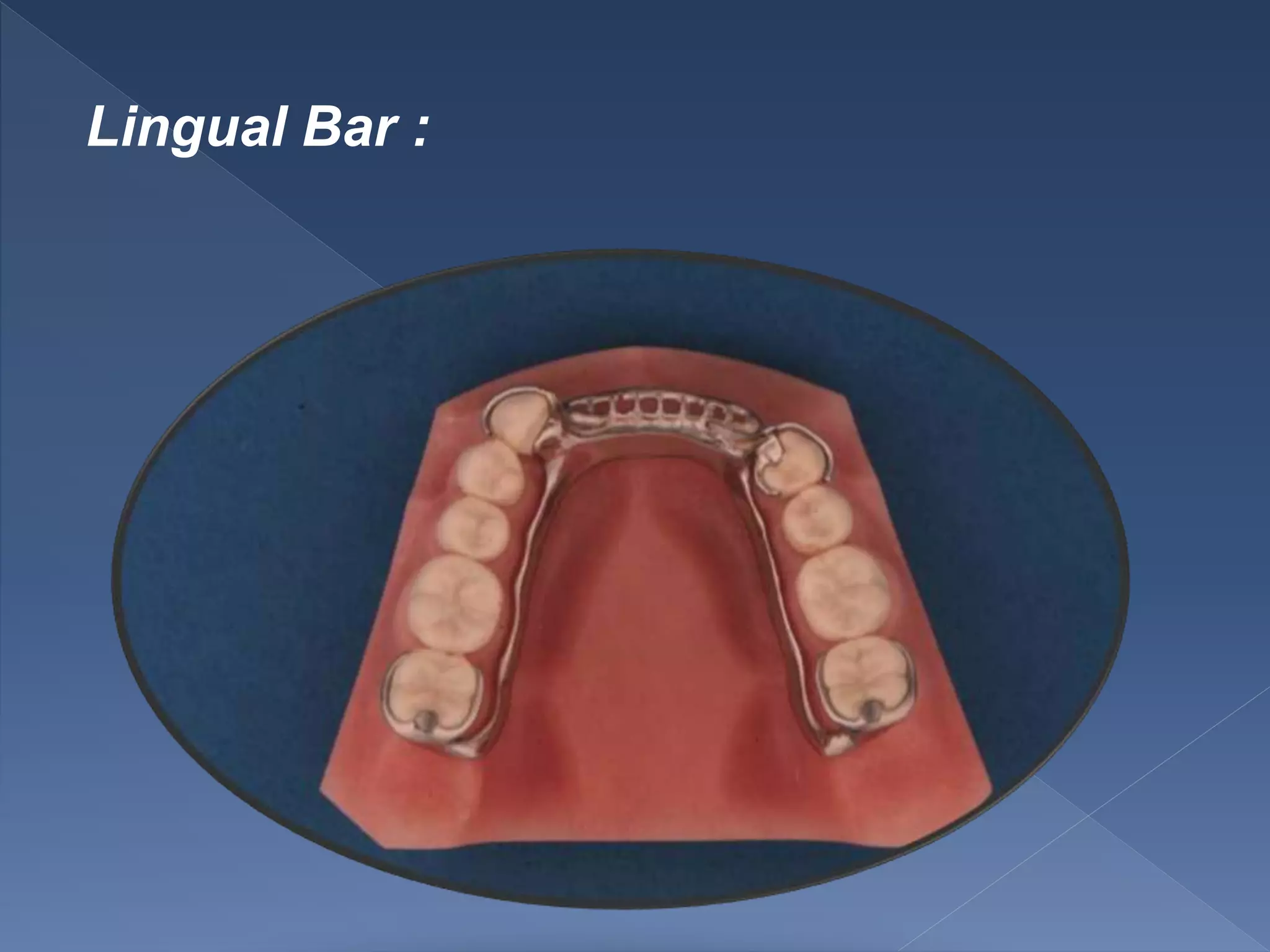 RPD Major Connectors | PPSX