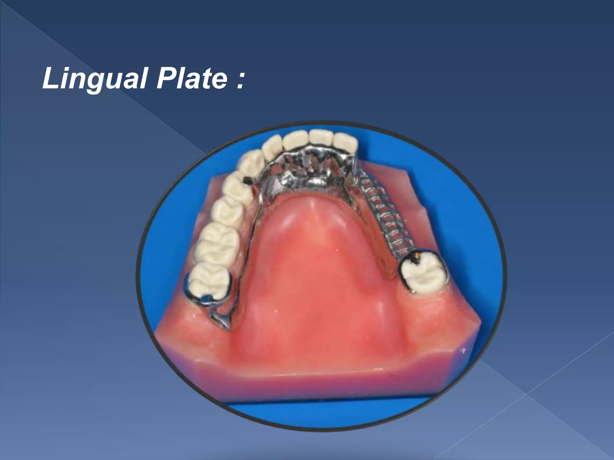 RPD Major Connectors | PPSX