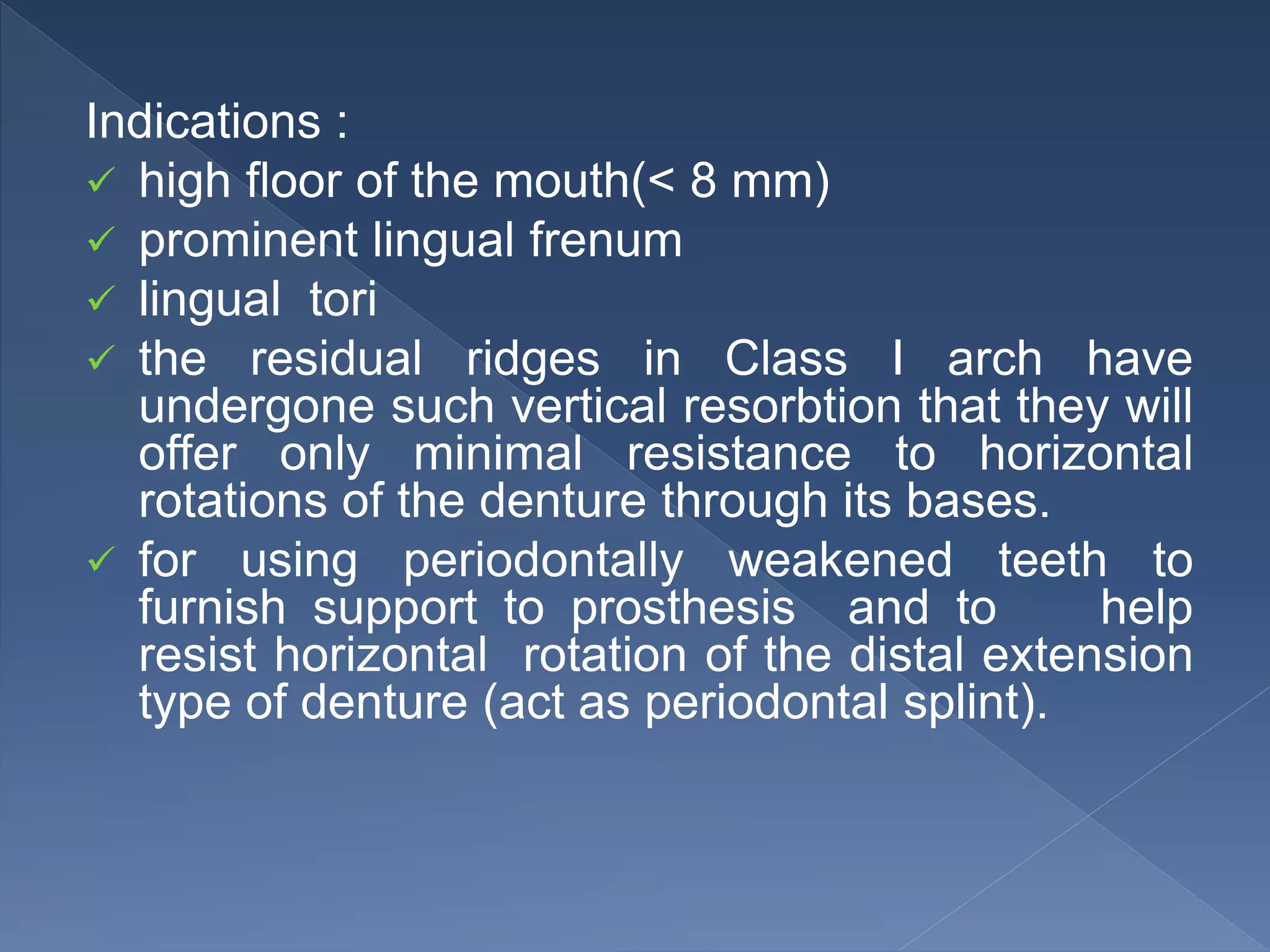 RPD Major Connectors | PPSX