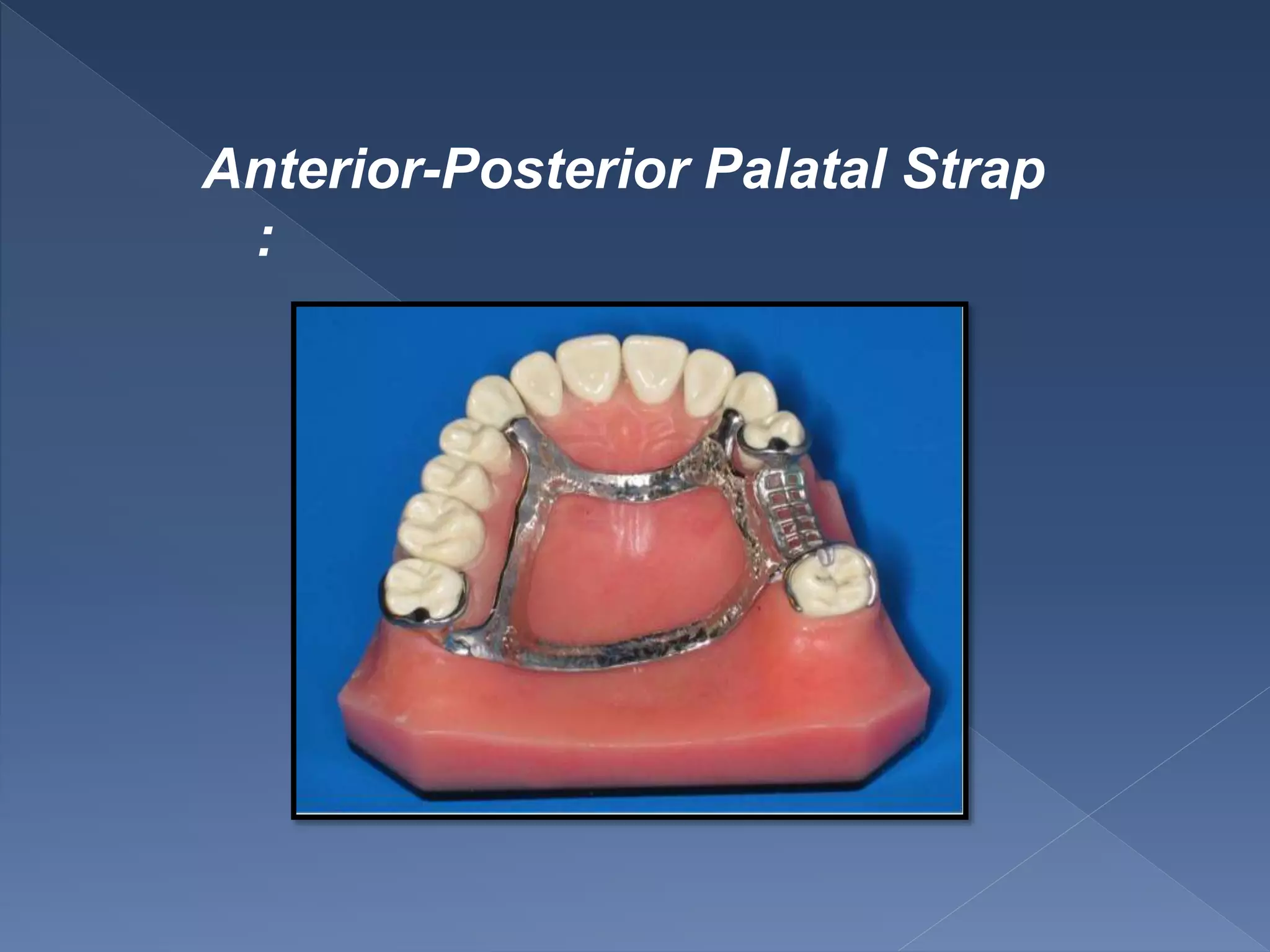 RPD Major Connectors | PPSX