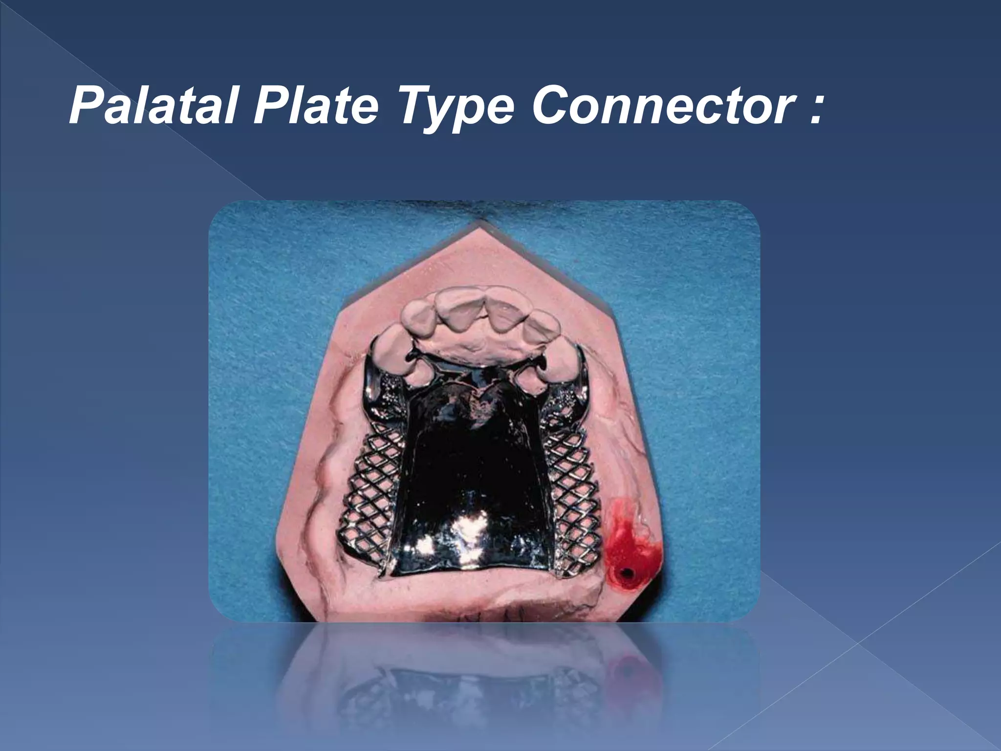 RPD Major Connectors | PPSX