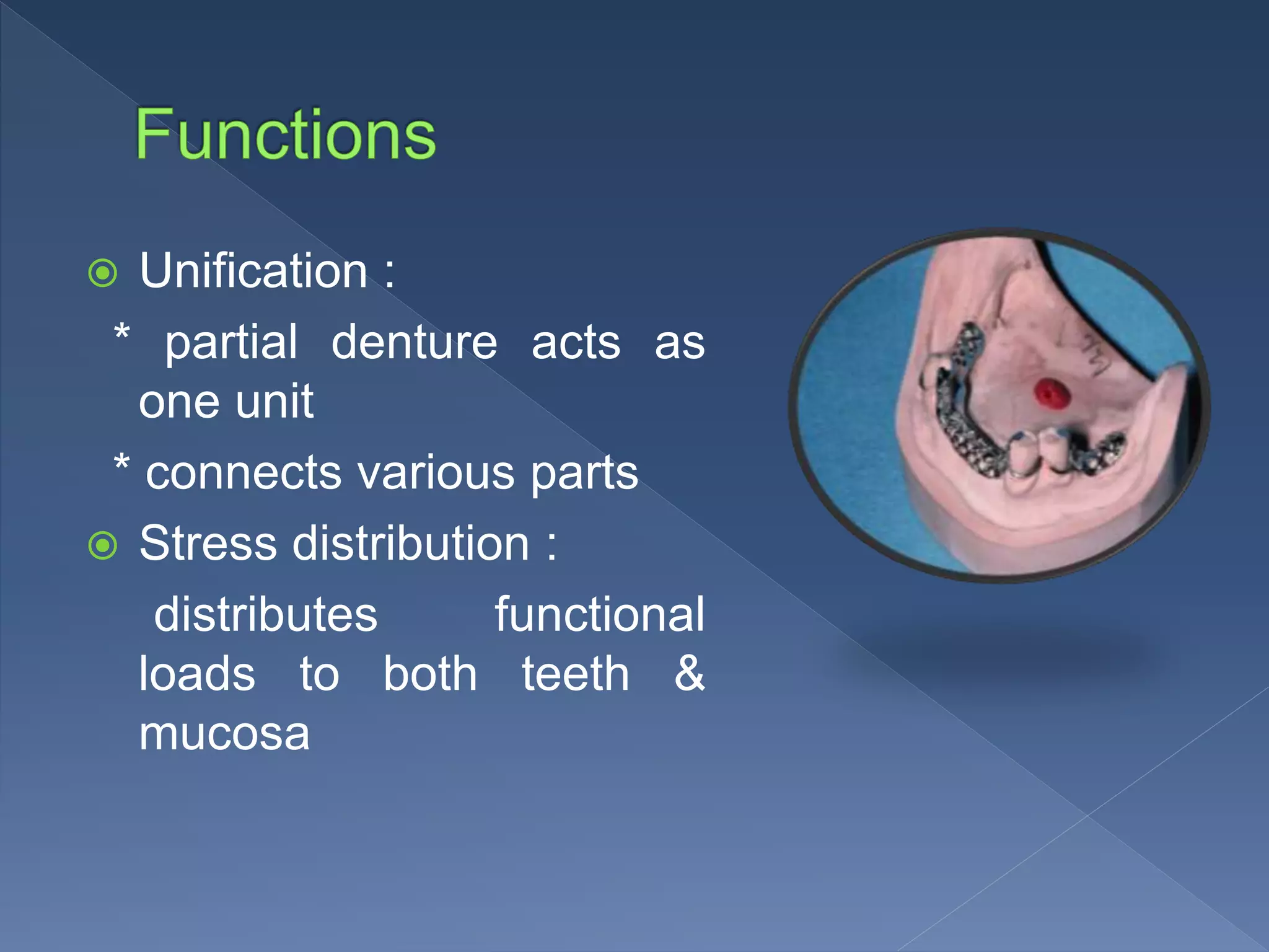 RPD Major Connectors | PPSX
