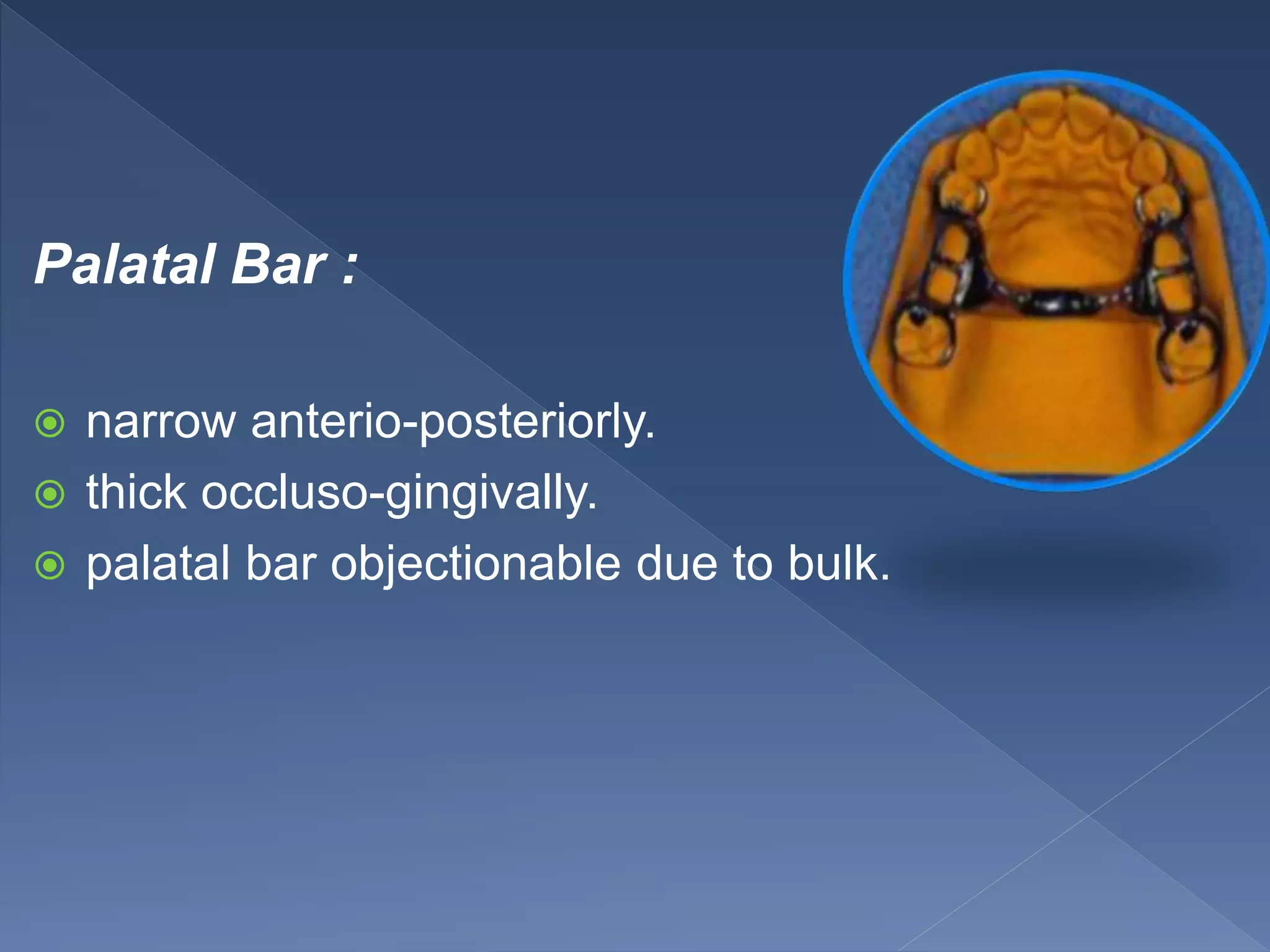 RPD Major Connectors | PPSX