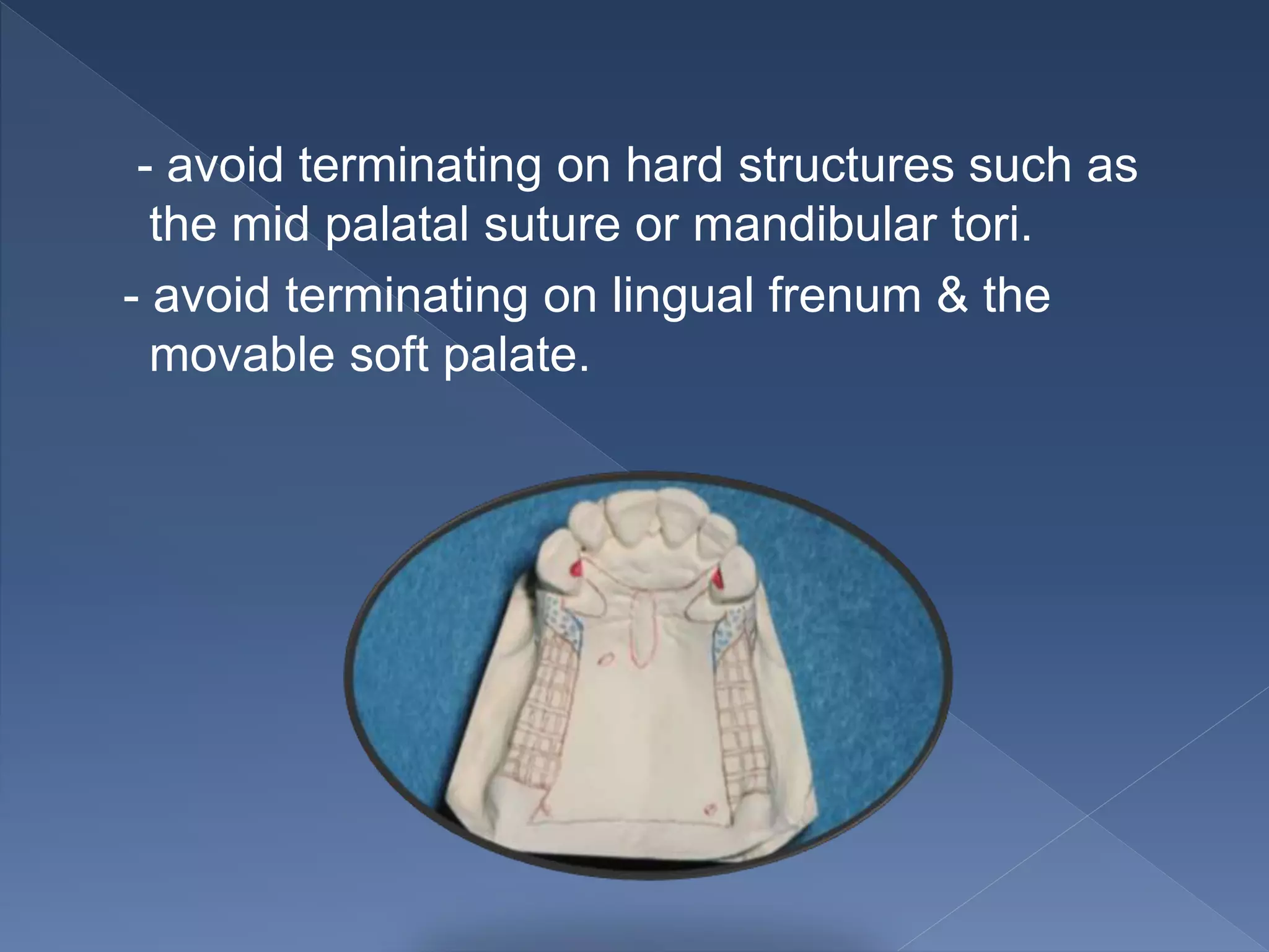 RPD Major Connectors | PPSX