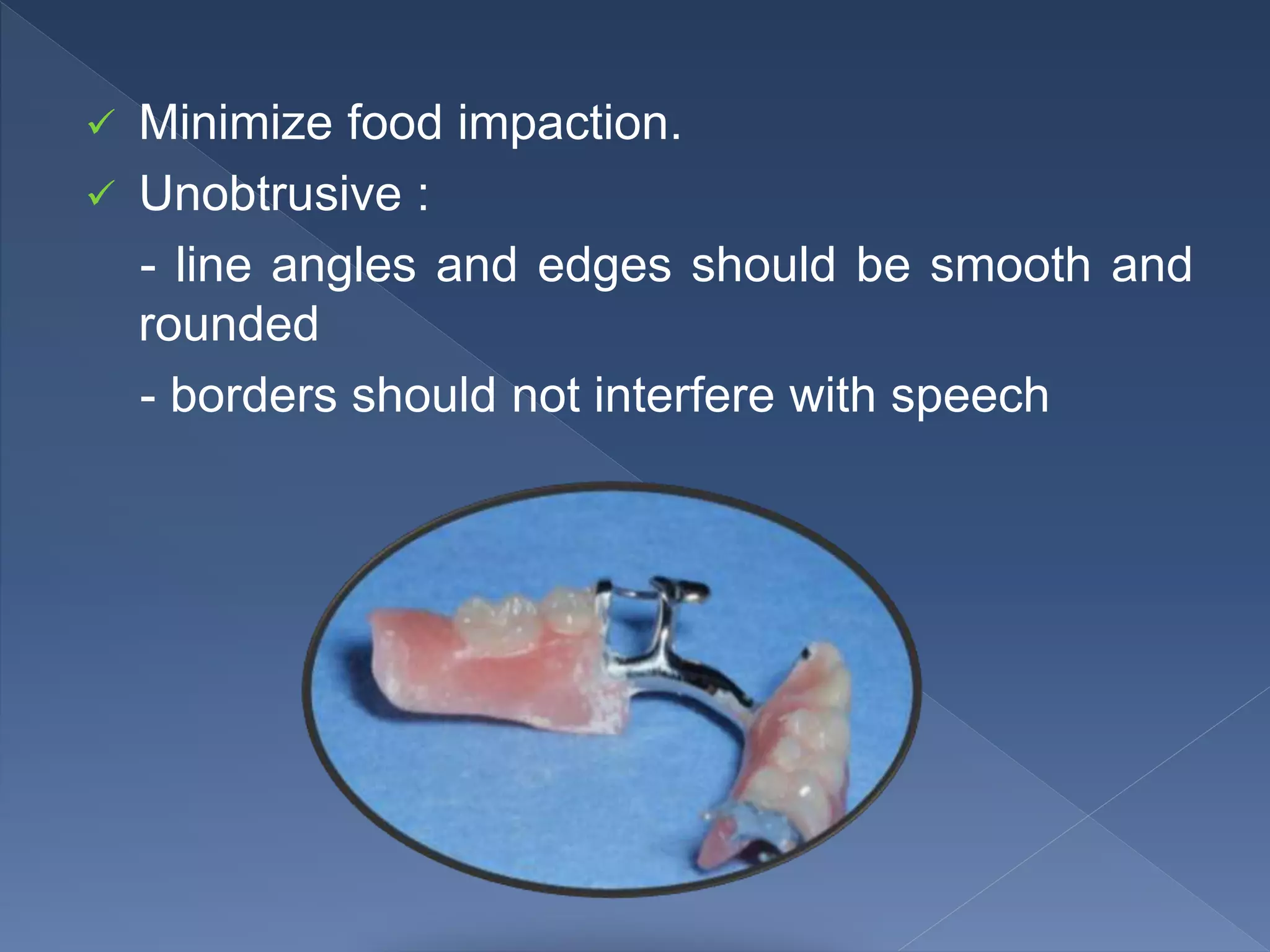 RPD Major Connectors | PPSX