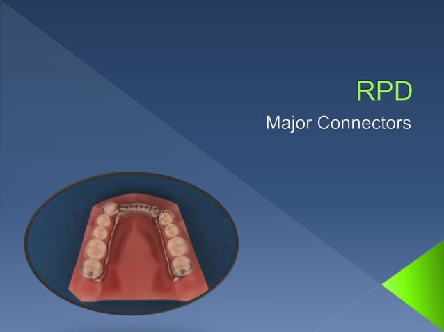 RPD Major Connectors | PPSX | Dental Health | Diseases and Conditions