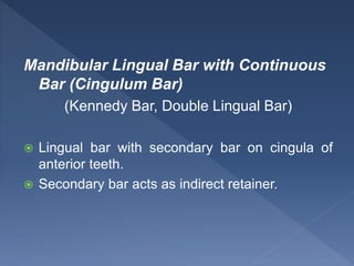 RPD Major Connectors | PPSX