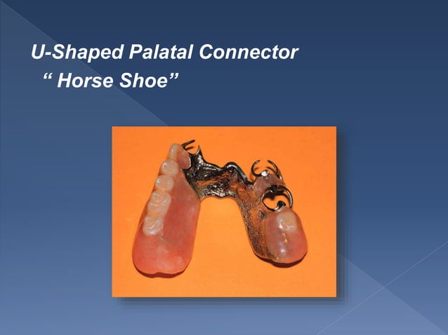 RPD Major Connectors | PPSX | Dental Health | Diseases and Conditions