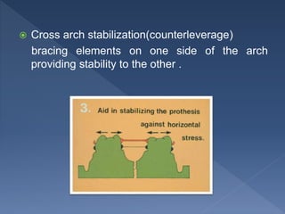 RPD Major Connectors | PPSX