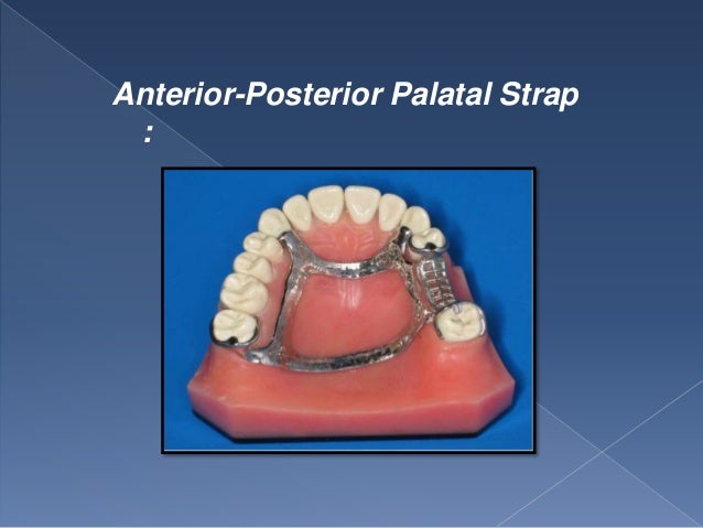 RPD Major Connectors