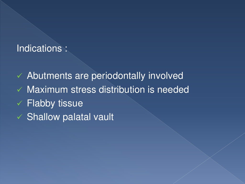 RPD Major Connectors