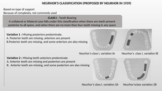 Classification of partially edentulous arches | PPTX