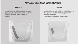 Classification of partially edentulous arches | PPTX | Dental Health ...