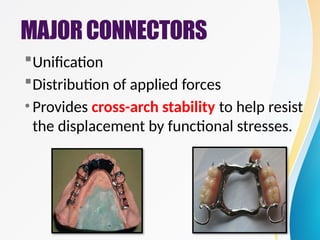Removable Partial Denture Framework .pptx