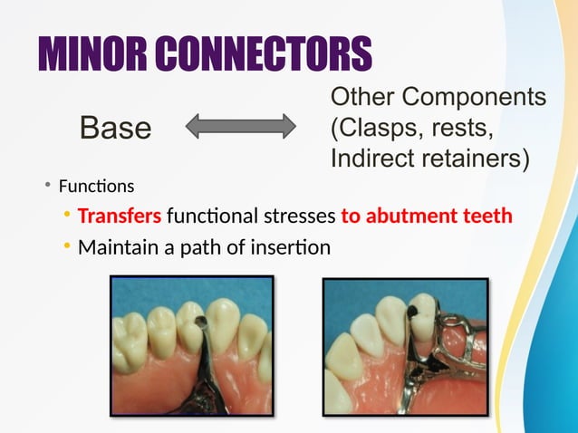 Removable Partial Denture Framework .pptx