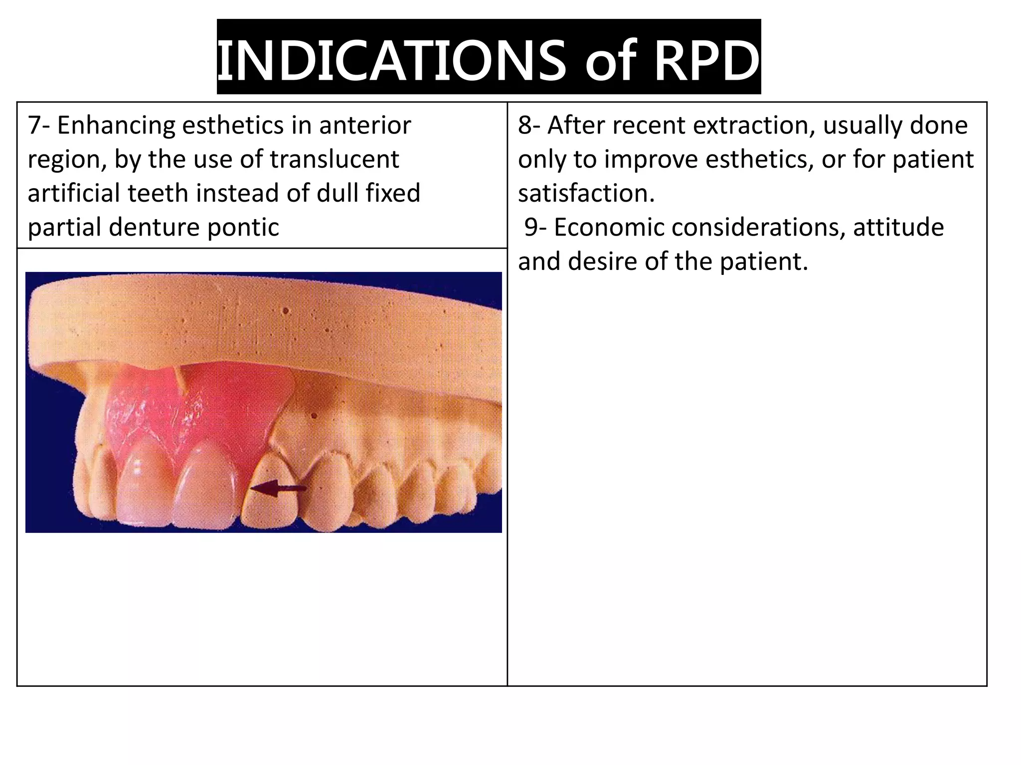 Removable Partial Denture 1. Introduction | PDF