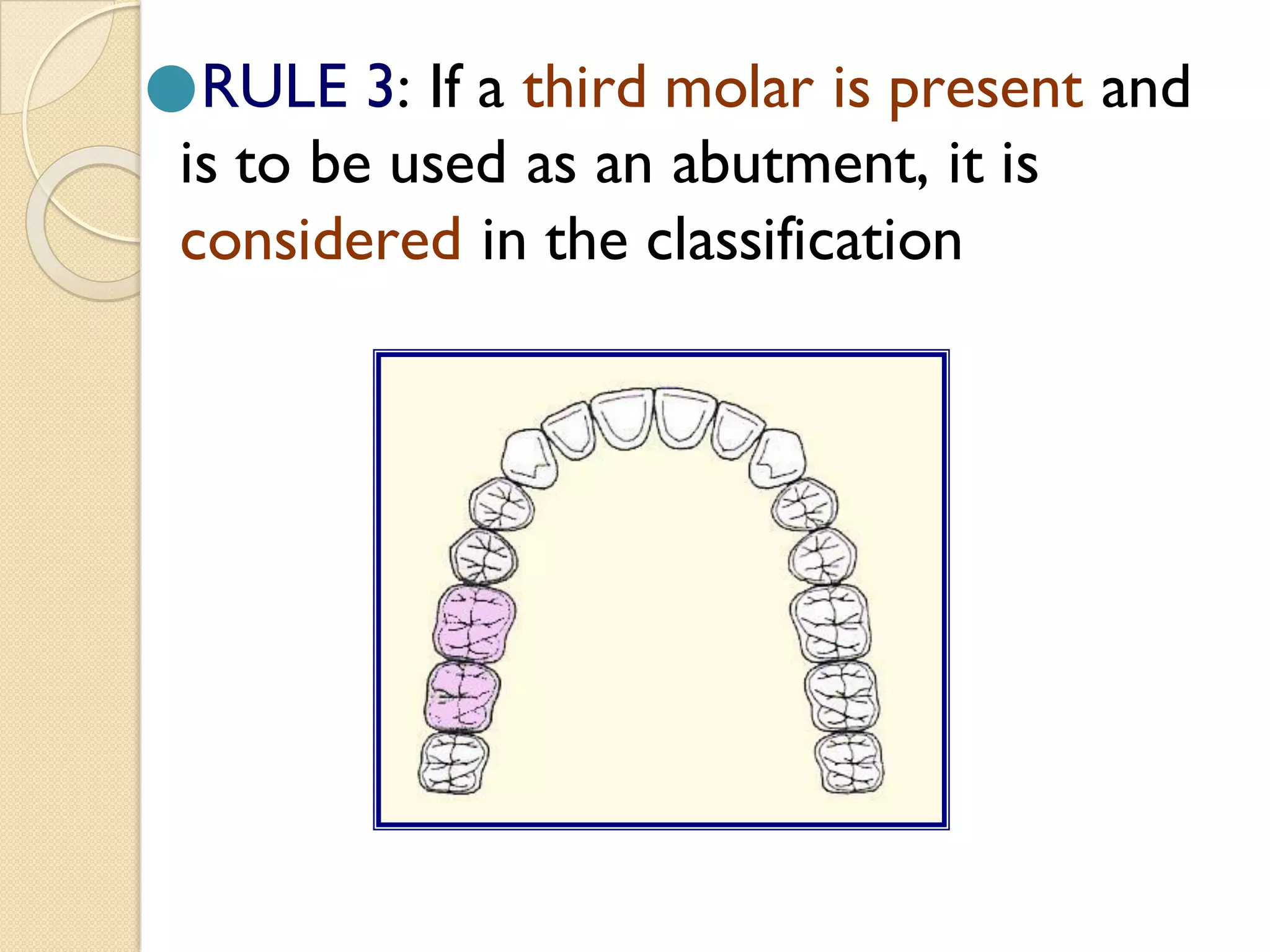 RPD Classification. | PDF